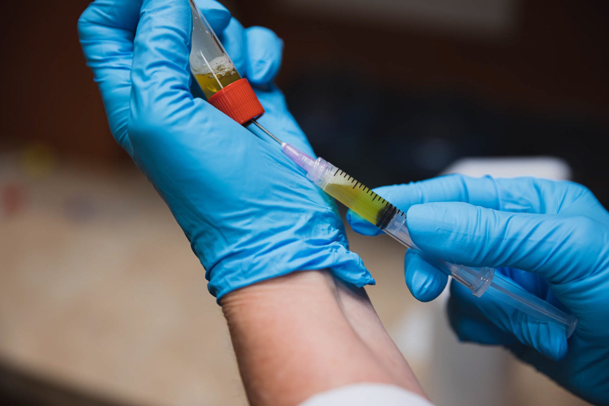 PRP Facial in Austin | Helio Health & Wellness